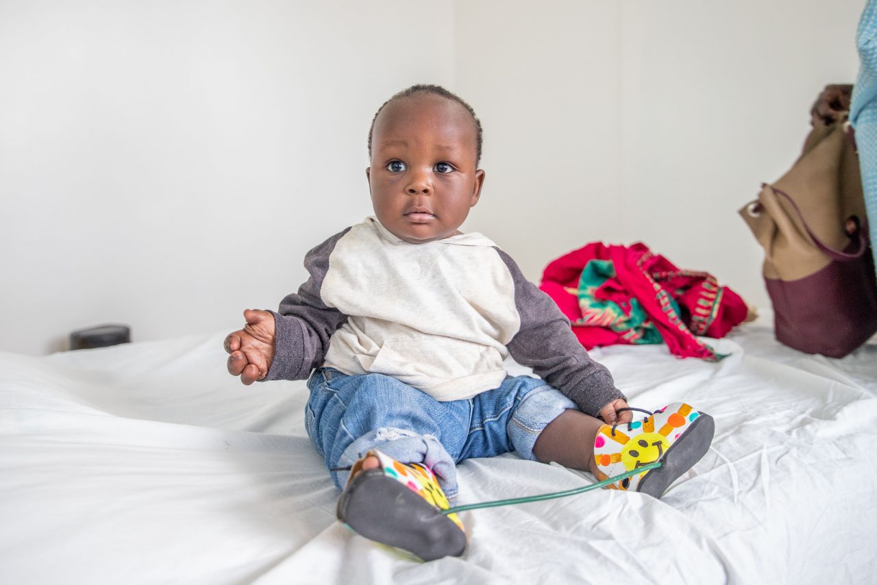 How Clubfoot Treatment Works - Hope Walks